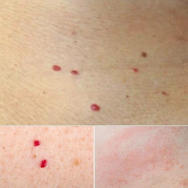 Red Spots on Skin: 13 Common Causes - Ypxle