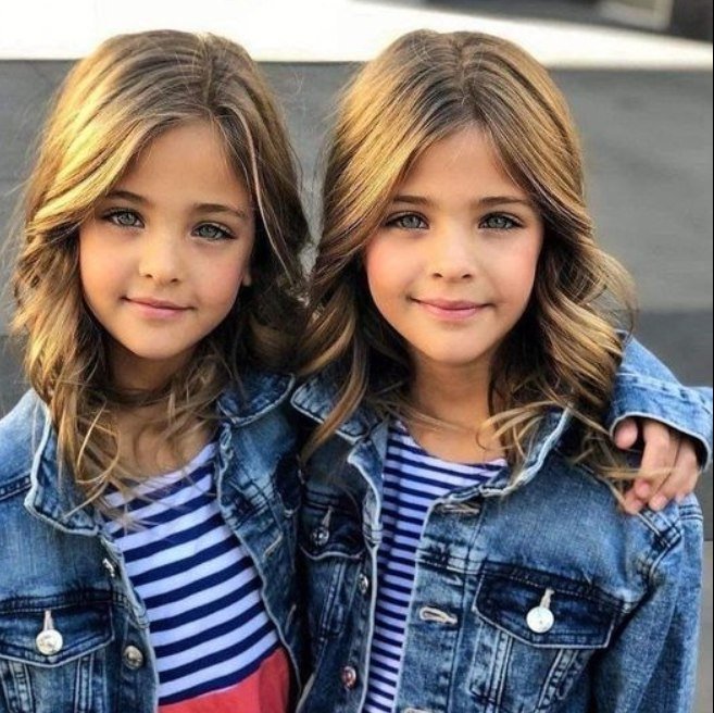 12 Years Ago They Were Called The World’s Most Beautiful Twins – Now ...